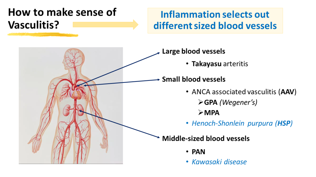 Vasculitis - Cassie and Friends Society